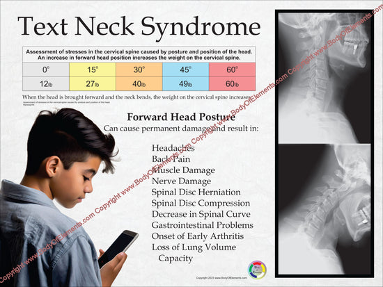 Text Neck Syndrome Poster Children – Body of Elements